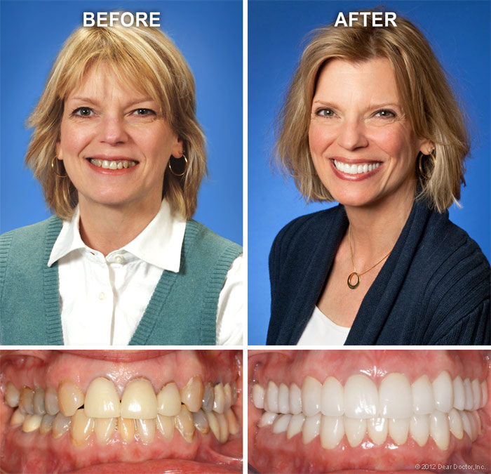 Cosmetic Dentistry Leslie J Green Dmd Llc King Of Prussia Pa