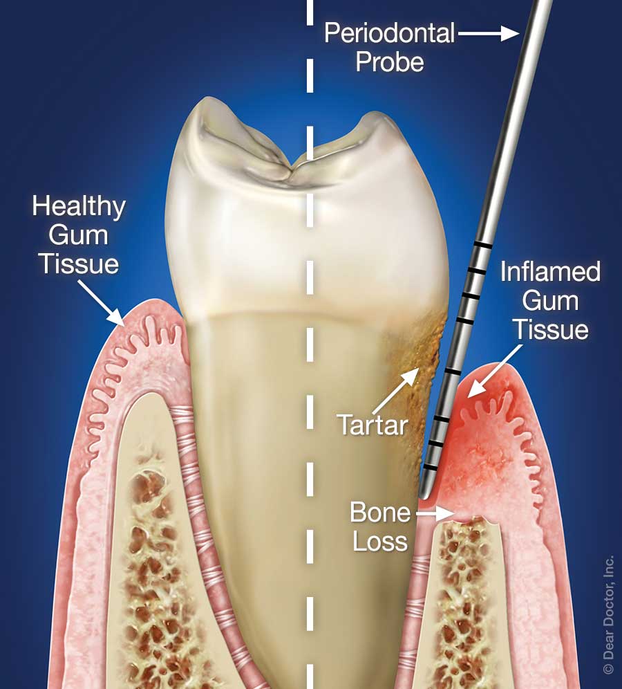 Periodontal Therapy Coastal Periodontics Implant Dentistry Mobile