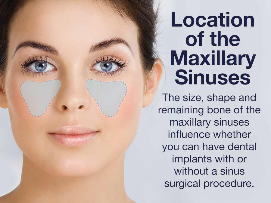 Sinus Cancer Surgery Pictures - CancerWalls